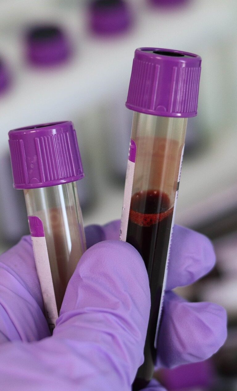 Cancer Test BMS Clinic cancer-test-bms-clinic